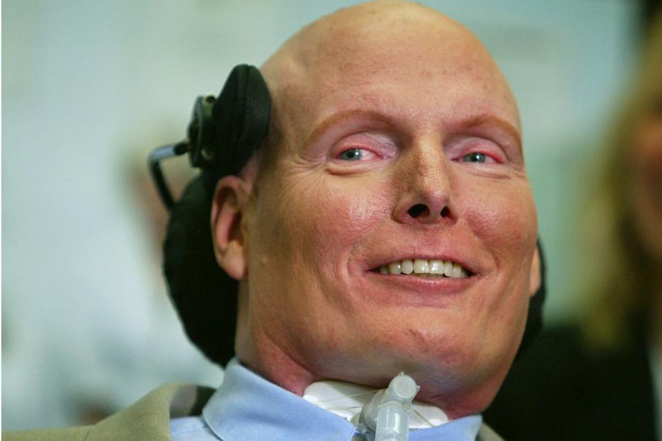 Un centímetro, una vida arruinada: el accidente que hizo que ...