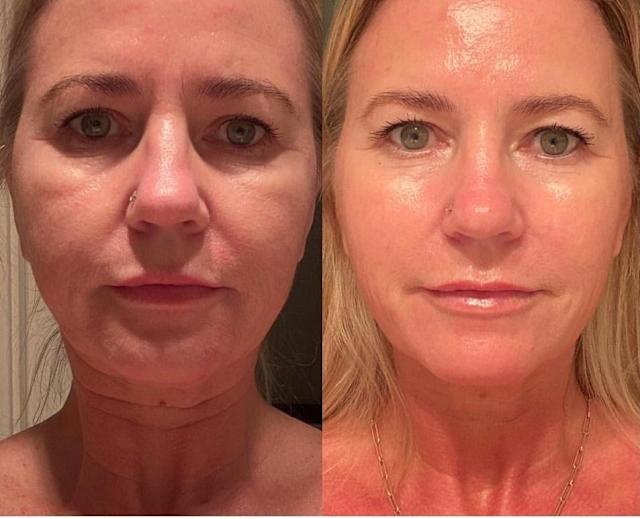 Ashley Black Launches New All-in-One Fascial Tool That May Be the ...