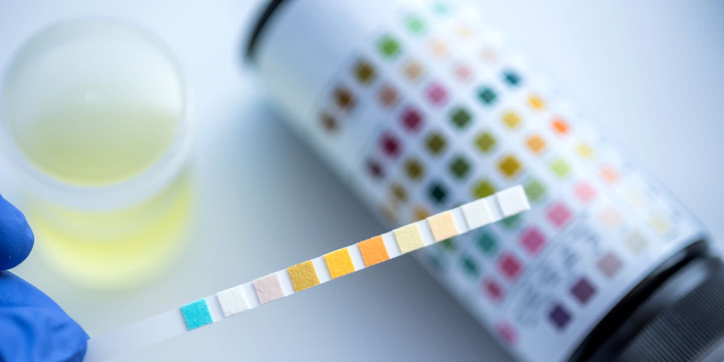 What the colour of your wee says about your health